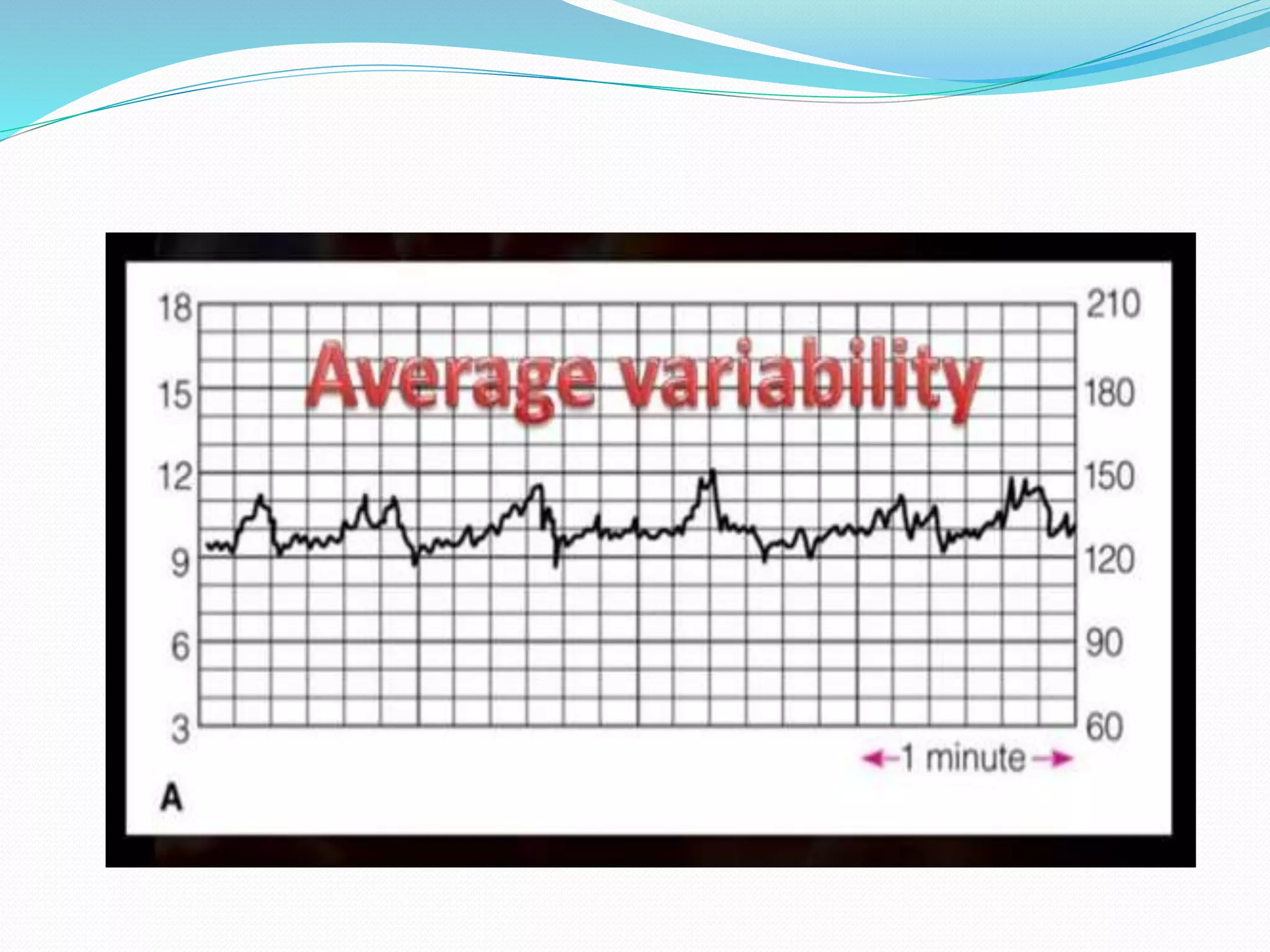 Intrapartum assessment of fetal well being (1) | PPTX