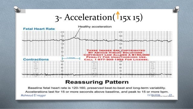 Intrapartum assessment of fetal wellbeing