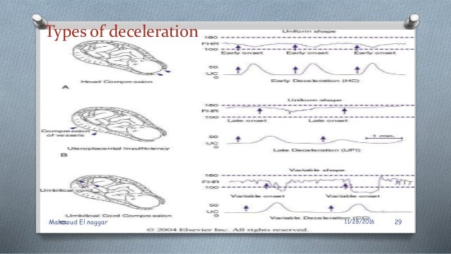 Intrapartum assessment of fetal wellbeing