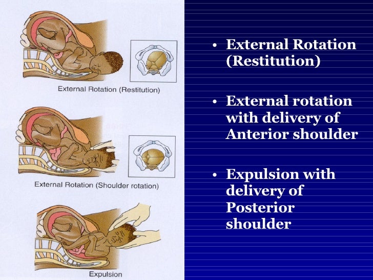 Intrapartum Care and Abnormal Labor