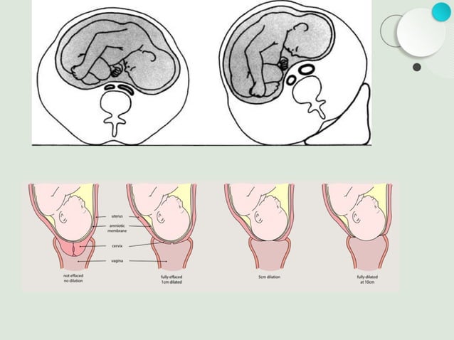 Intrapartum care for high risk women | PPT | Pregnancy | Reproductive ...