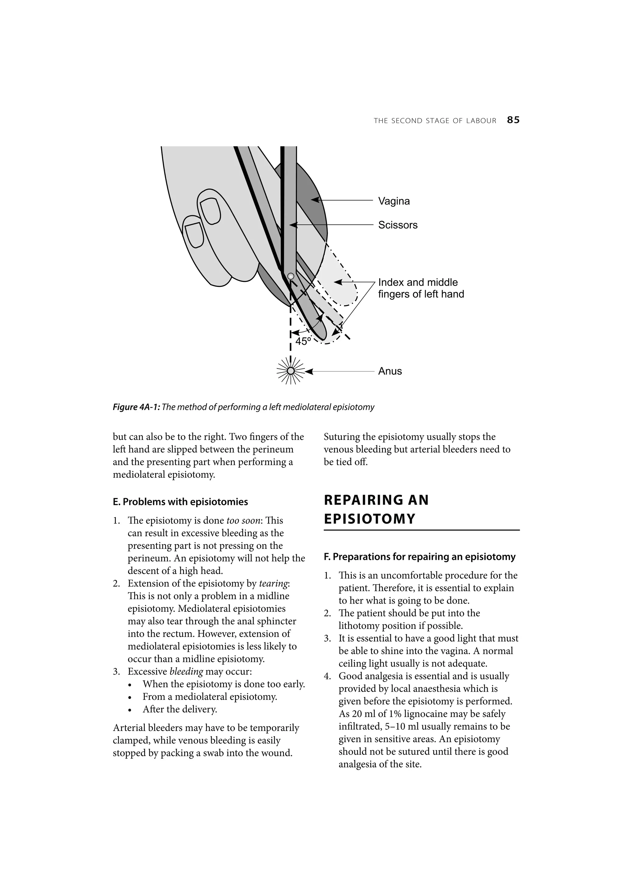 Intrapartum Care: Skills workshop Performing and repairing an ...