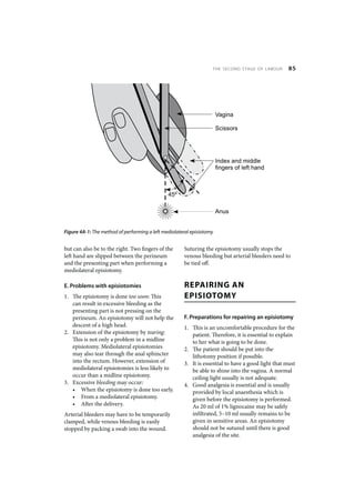 Intrapartum Care: Skills workshop Performing and repairing an ...
