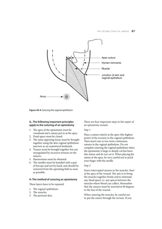 Intrapartum Care: Skills workshop Performing and repairing an ...