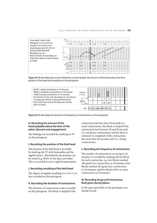 Intrapartum Care: Skills workshop Recording observations on the ...
