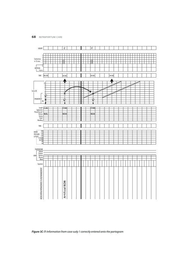 Intrapartum Care: Skills workshop Recording observations on the partogram | PDF | Pregnancy ...