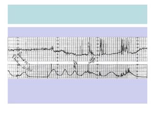 Intrapartum fetal assessment | PPTX