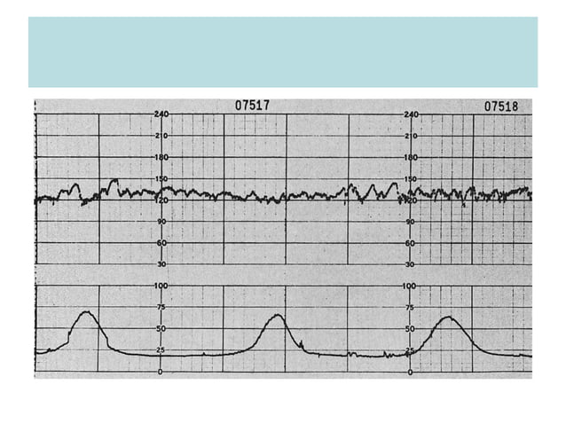Intrapartum fetal assessment | PPTX | Pregnancy | Reproductive Health