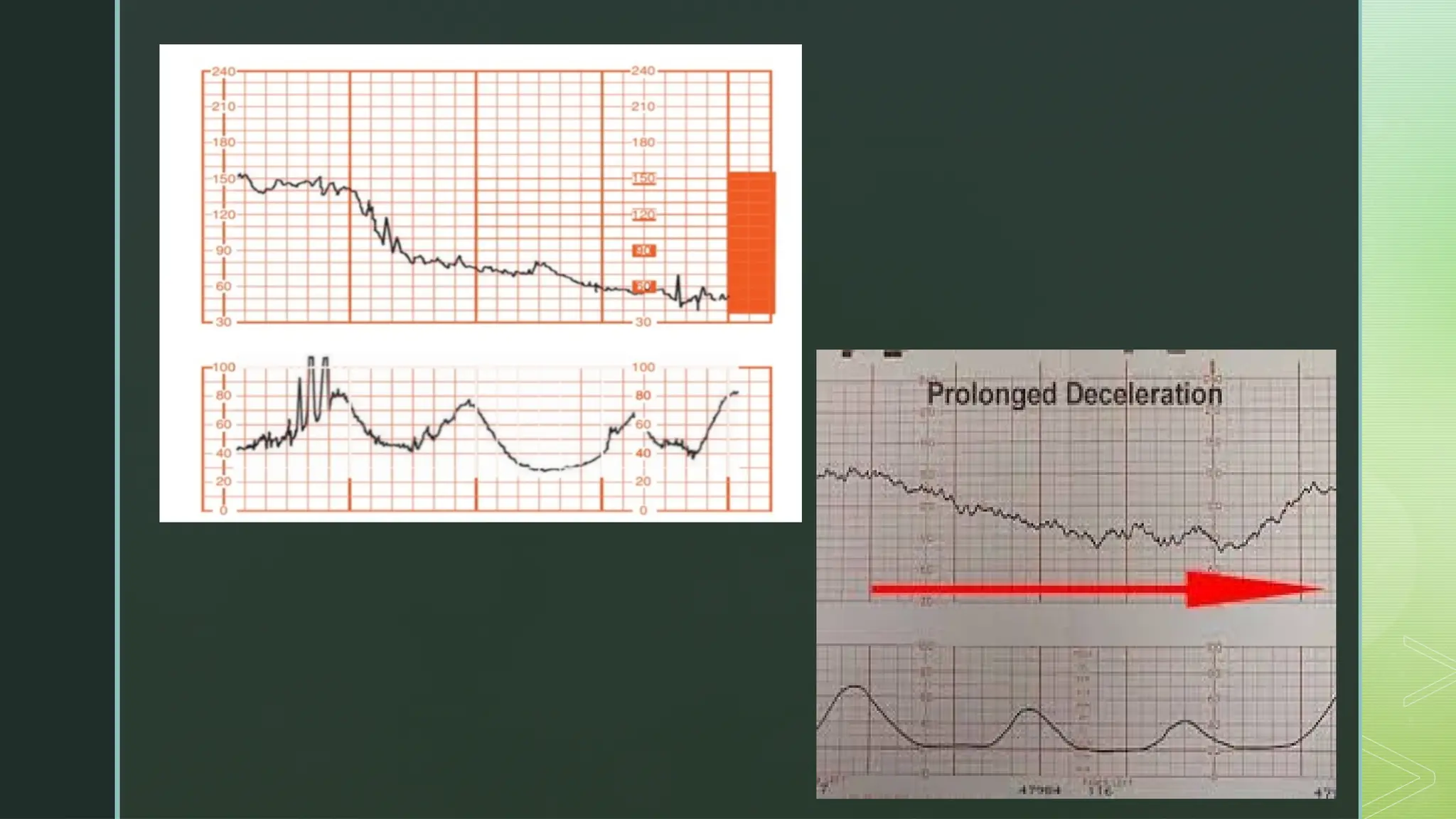 INTRAPARTUM FETAL ASSESSMENT 1.pptx