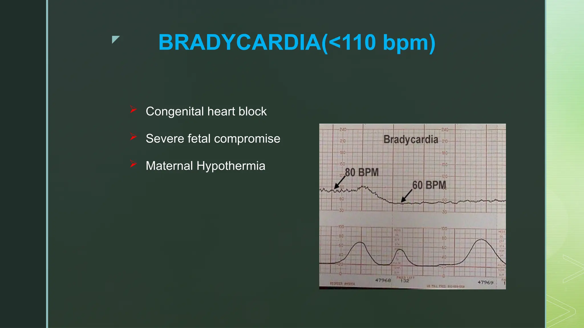INTRAPARTUM FETAL ASSESSMENT 1.pptx