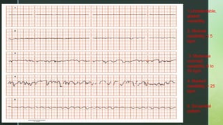 INTRAPARTUM FETAL ASSESSMENT 1.pptx