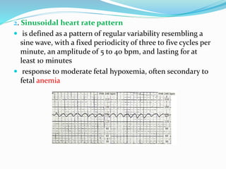 Intrapartum fetal heart rate assessment | PPTX