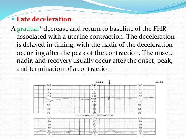 Intrapartum fetal heart rate assessment