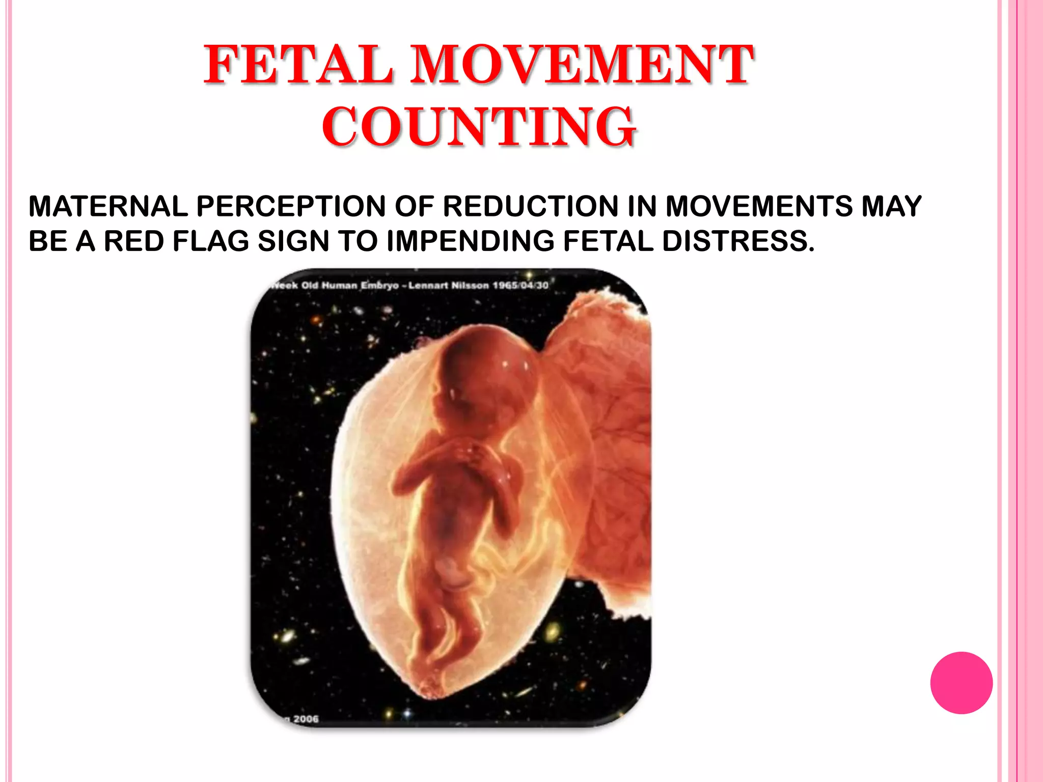 Intrapartum fetal monitering | PPTX