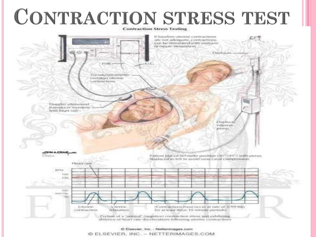 Intrapartum fetal monitering | PPTX | Pregnancy | Reproductive Health