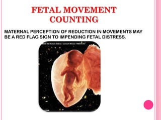 Intrapartum fetal monitering | PPTX