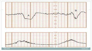 Intrapartum fetal monitoring | PDF