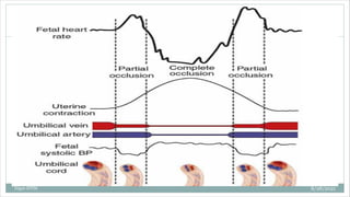 Intrapartum fetal monitoring | PDF