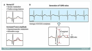Intrapartum fetal monitoring | PDF