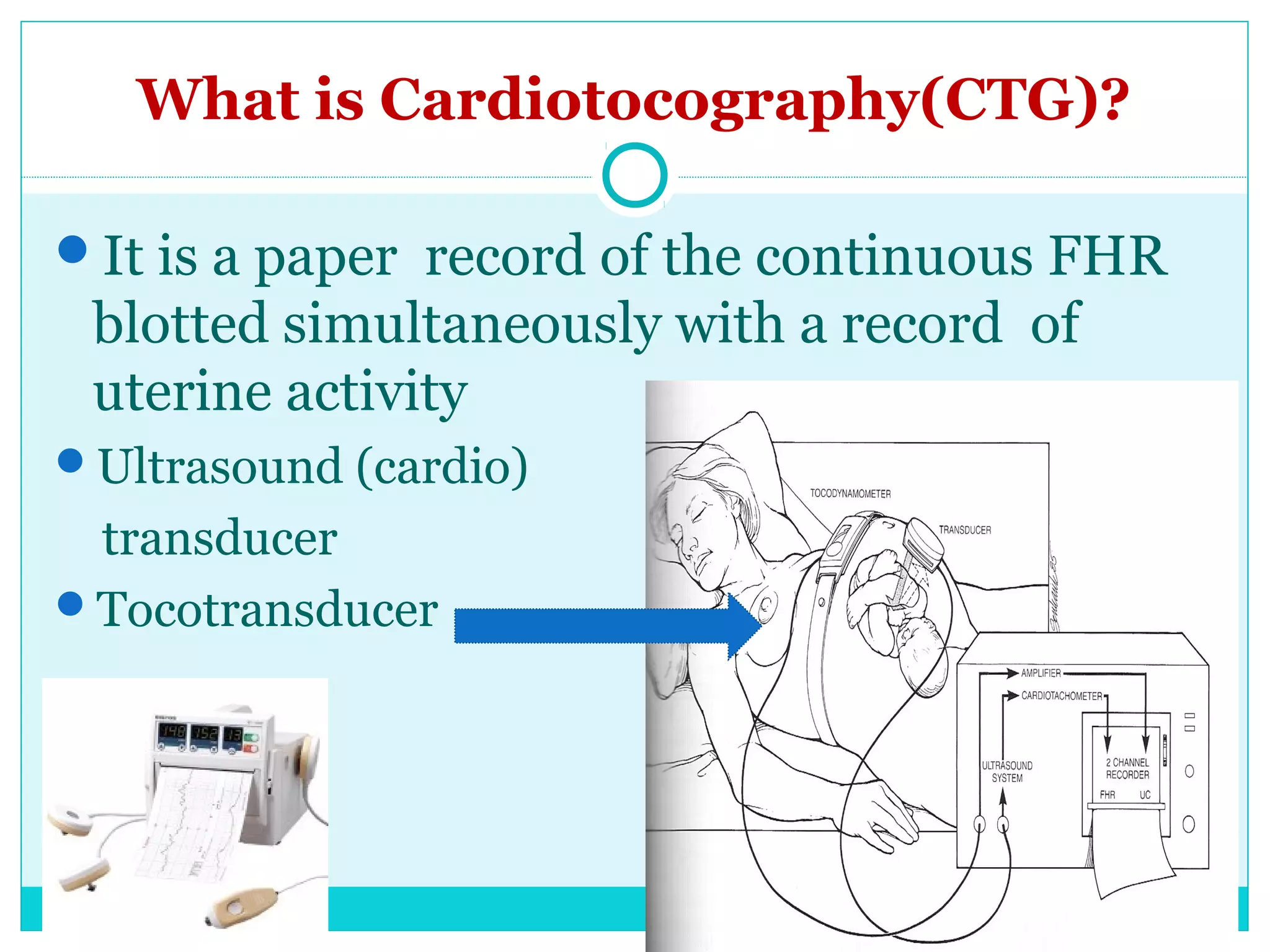 Intrapartum fetal monitoring for undergraduate | PPT