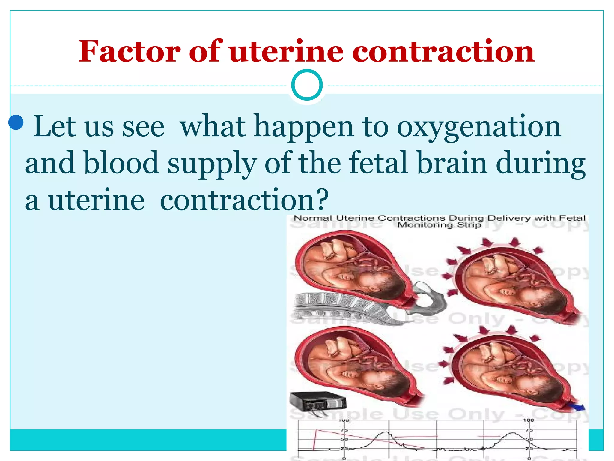 Intrapartum fetal monitoring for undergraduate | PPT