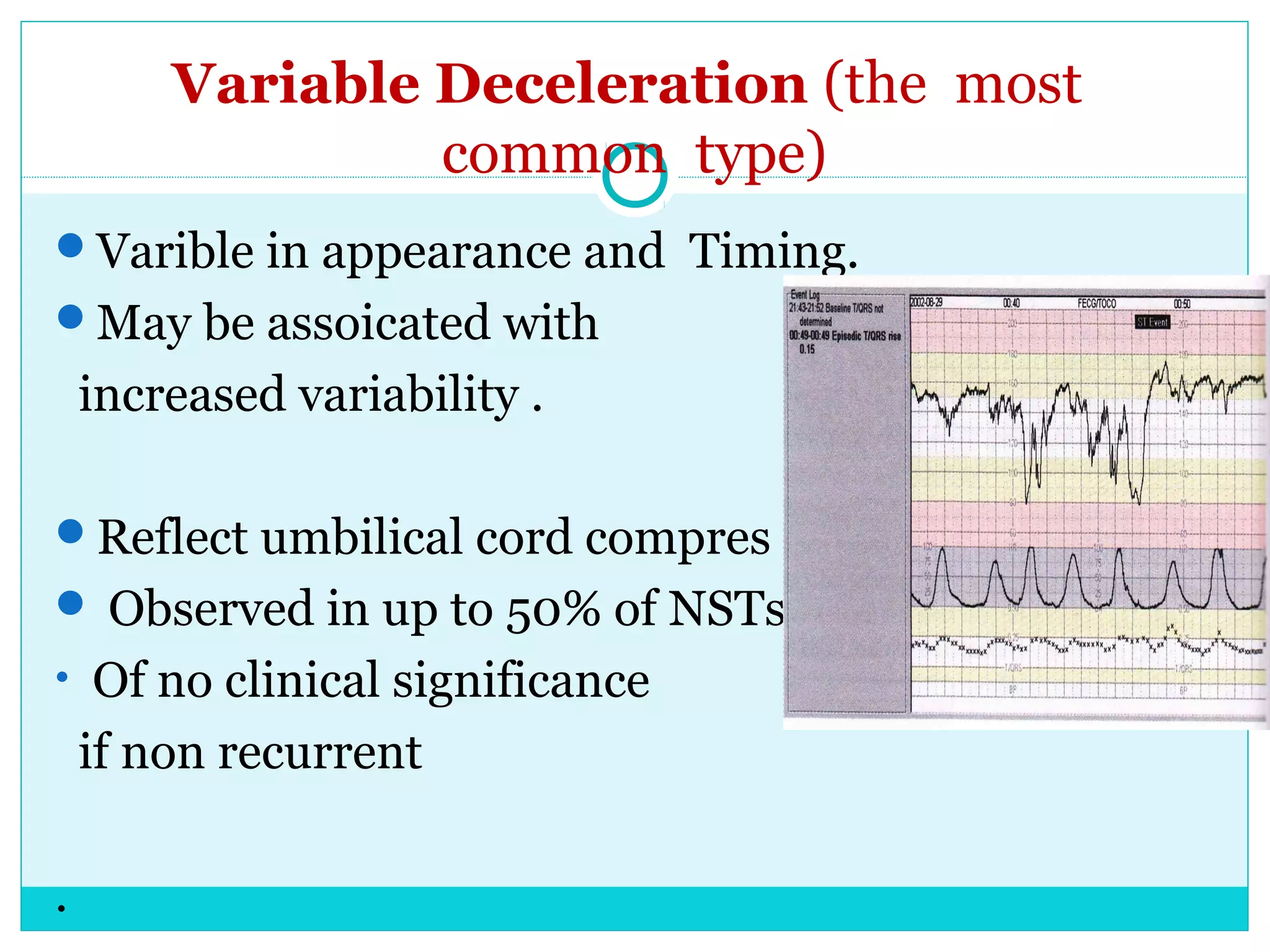 Intrapartum fetal monitoring for undergraduate | PPT