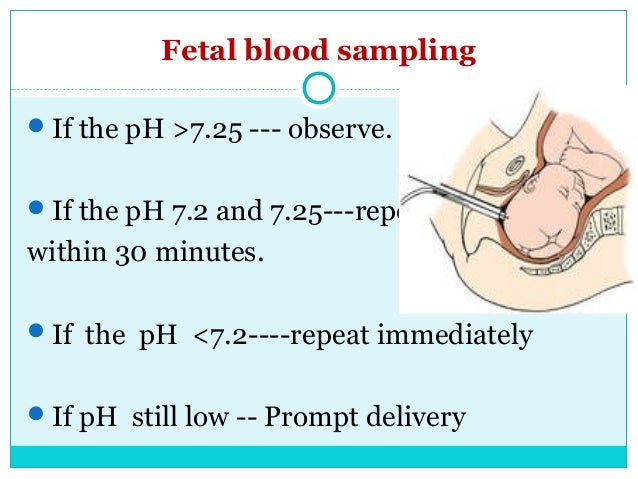 Intrapartum fetal monitoring for undergraduate