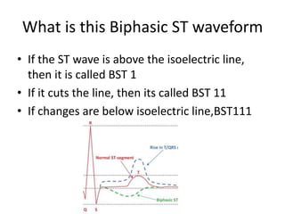 Intrapartum fetal surveillance | PPTX