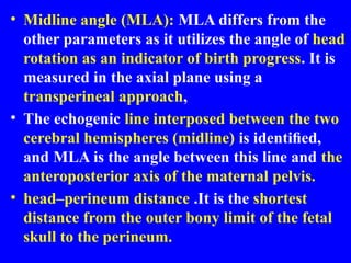 Intrapartum transperineal ultrasound.pptx