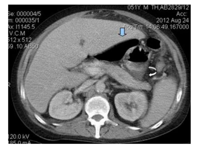 Intraperitoneal anatomy | PDF