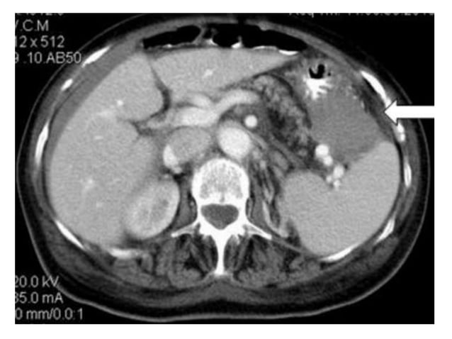 Intraperitoneal anatomy | PDF
