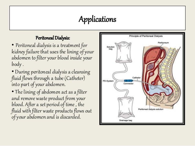 Intra peritoneal (ip) route of drug administration | PPTX
