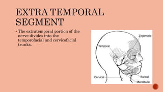 Intratemporal course of facial nerve | PPTX