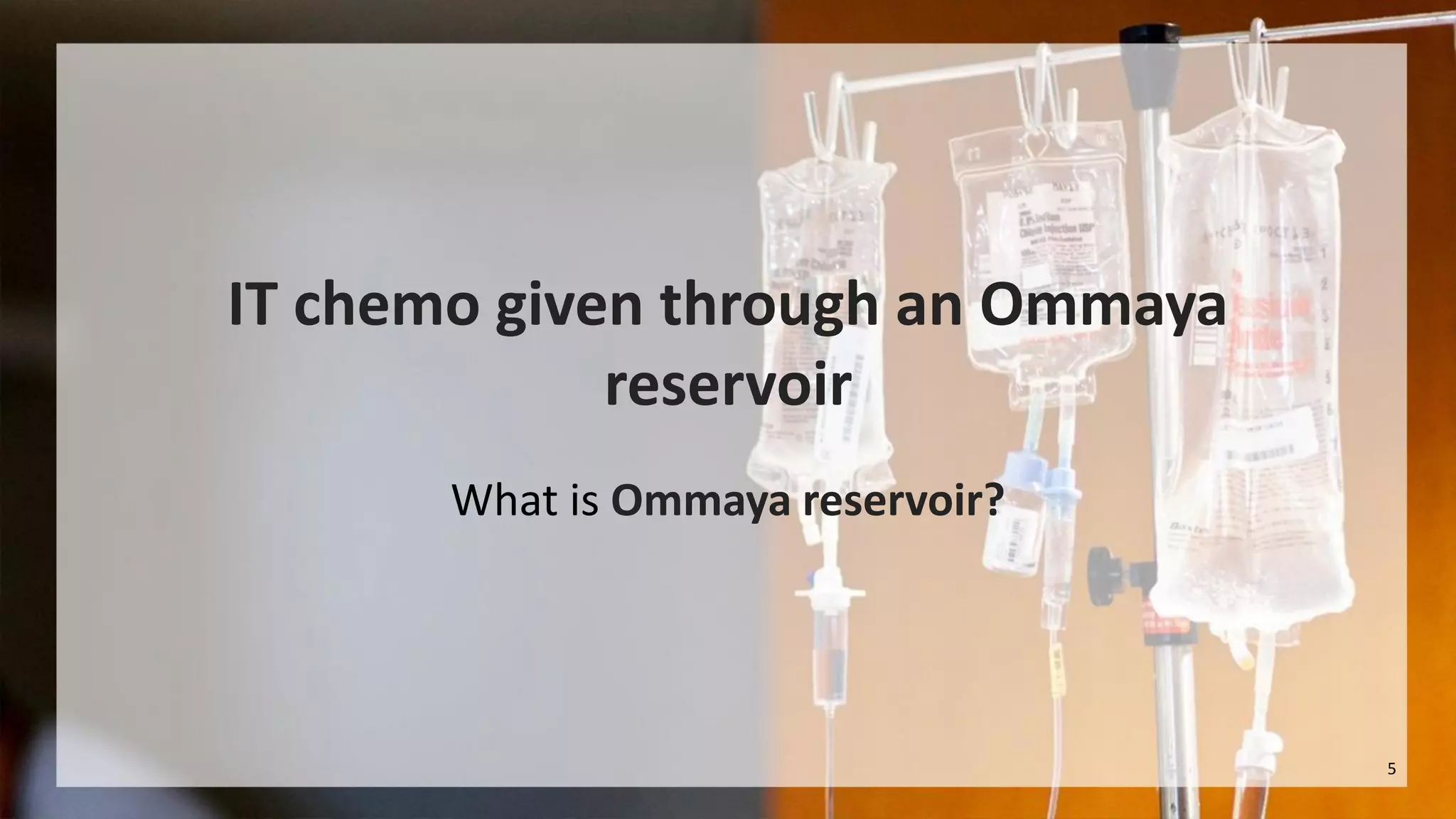Intrathecal route for chemotherapy | PDF
