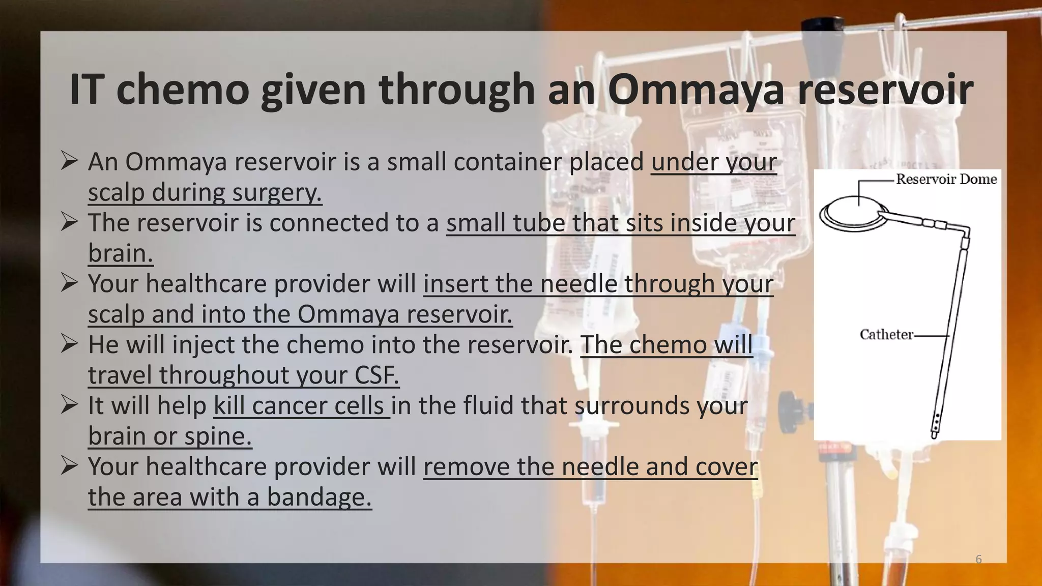 Intrathecal route for chemotherapy | PDF