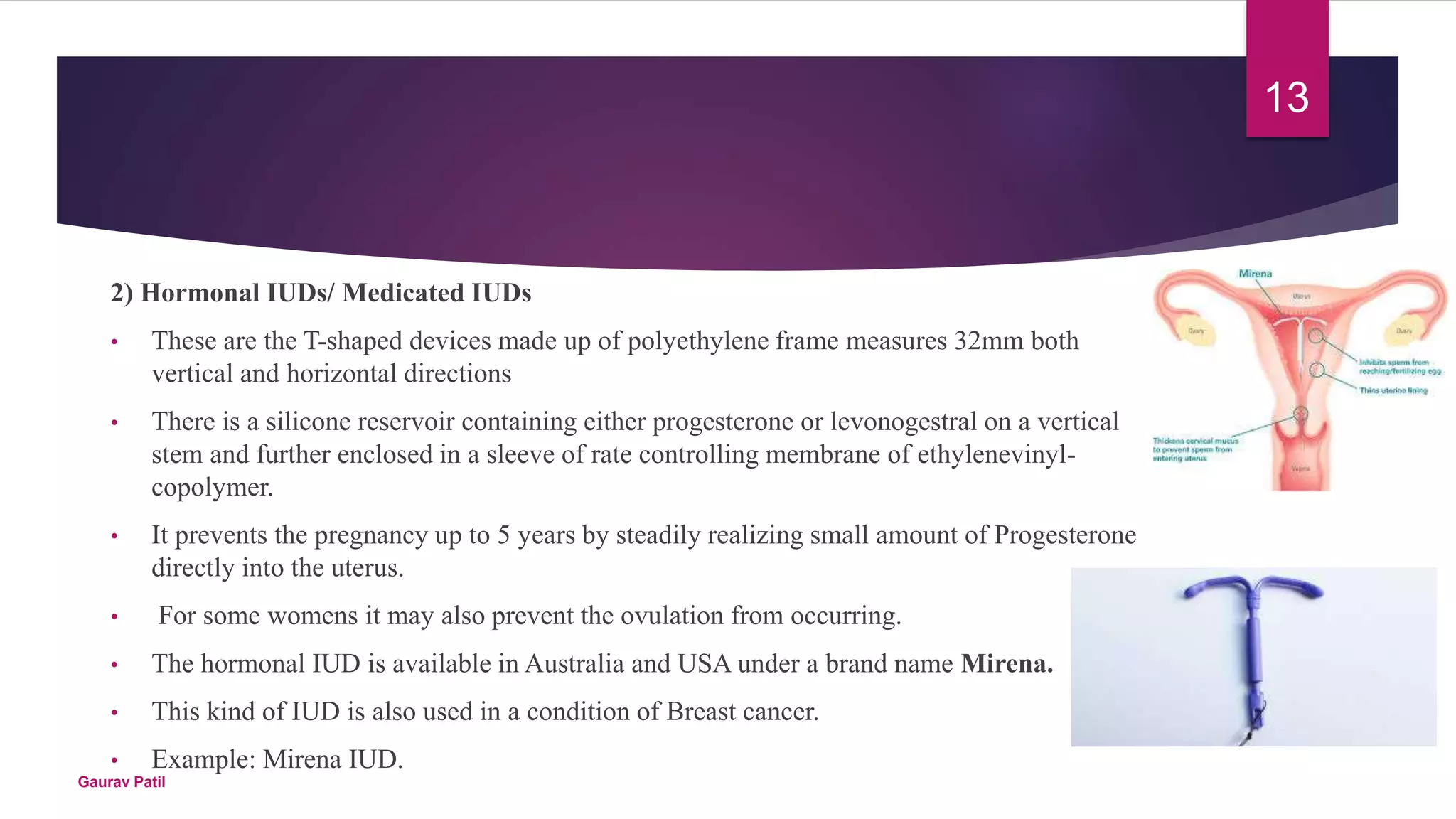 Intrauterine and Intravaginal drug delivery system | PPT