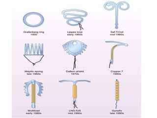 Intrauterine contraceptive device | PPTX