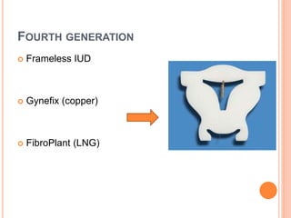 Intrauterine contraceptive devices .pptx