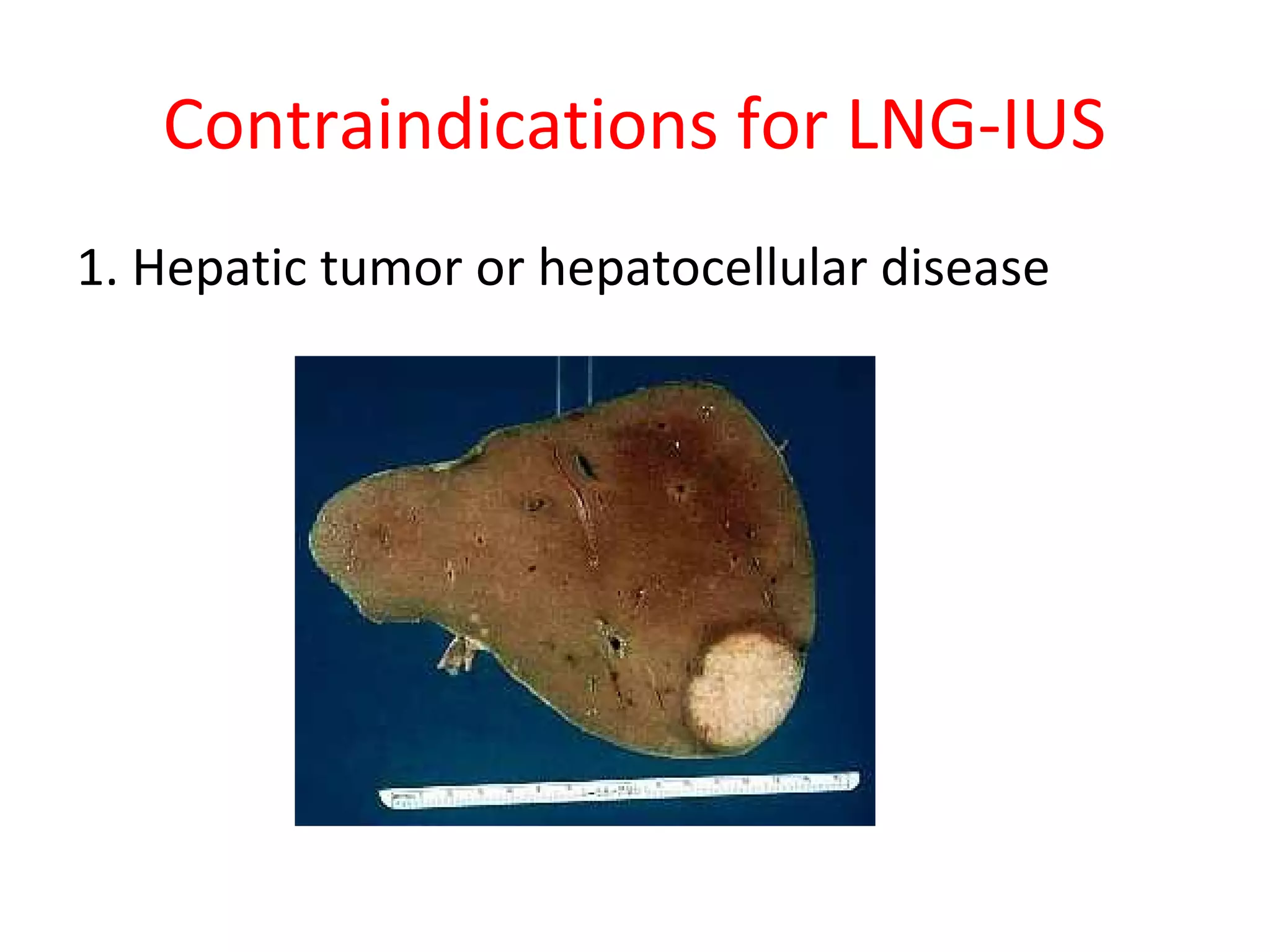 Intrauterine contraceptive devices ( IUCDs) | PPT