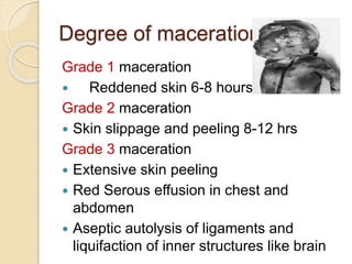 INTRAUTERINE DEATH CME ON INDUCTION OF LABOUR ON 8TH NOVEMBER 2016, Dr ...