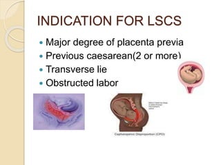 INTRAUTERINE DEATH CME ON INDUCTION OF LABOUR ON 8TH NOVEMBER 2016, Dr ...