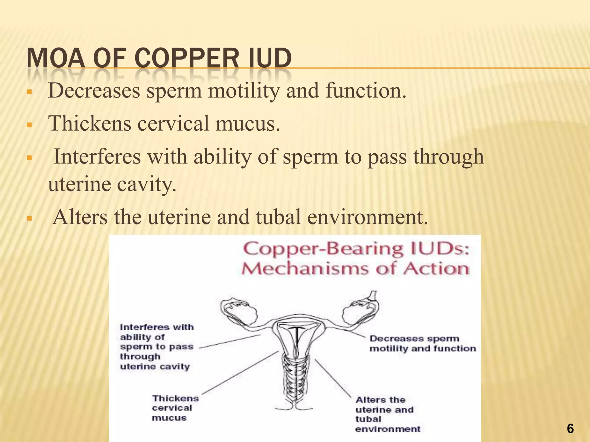 Intrauterine devices | PPTX
