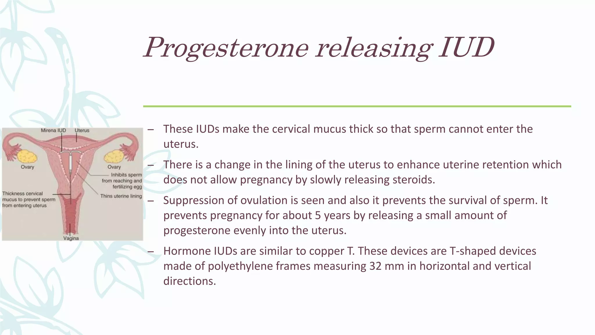 Intrauterine drug delivery system | PPTX