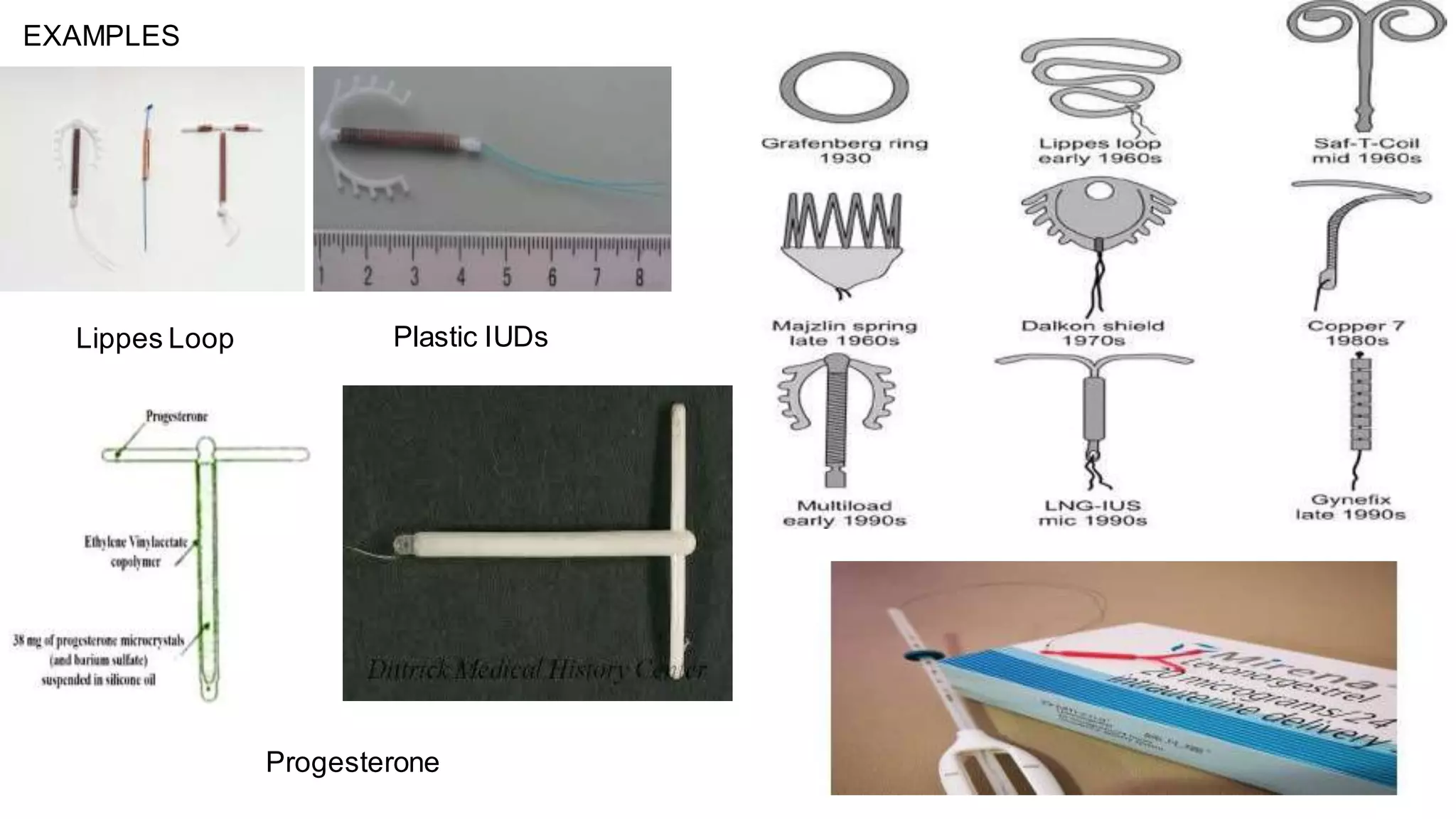 INTRAUTERINE DRUG DELIVERY SYSTEM.docx