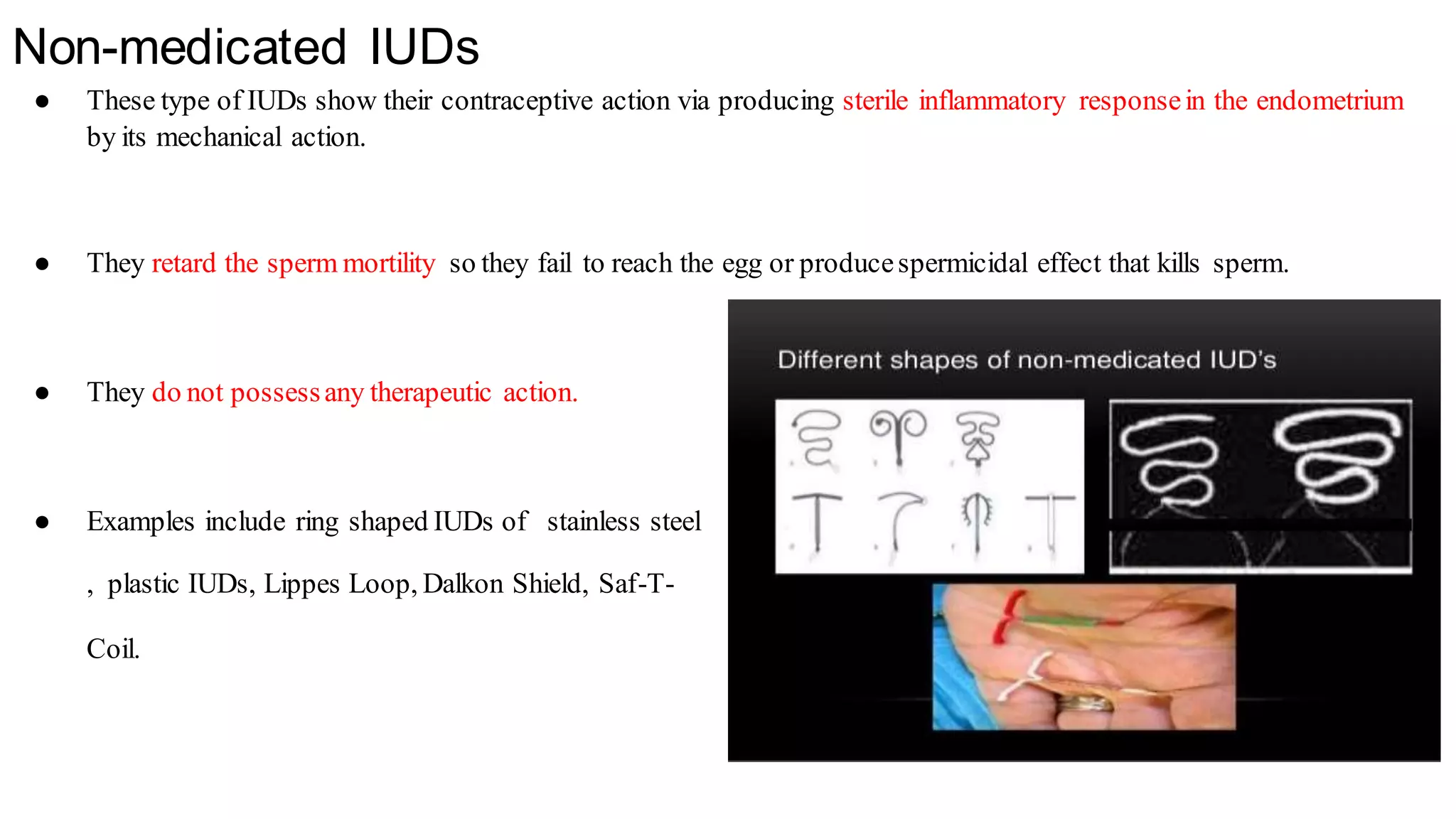 INTRAUTERINE DRUG DELIVERY SYSTEM.docx
