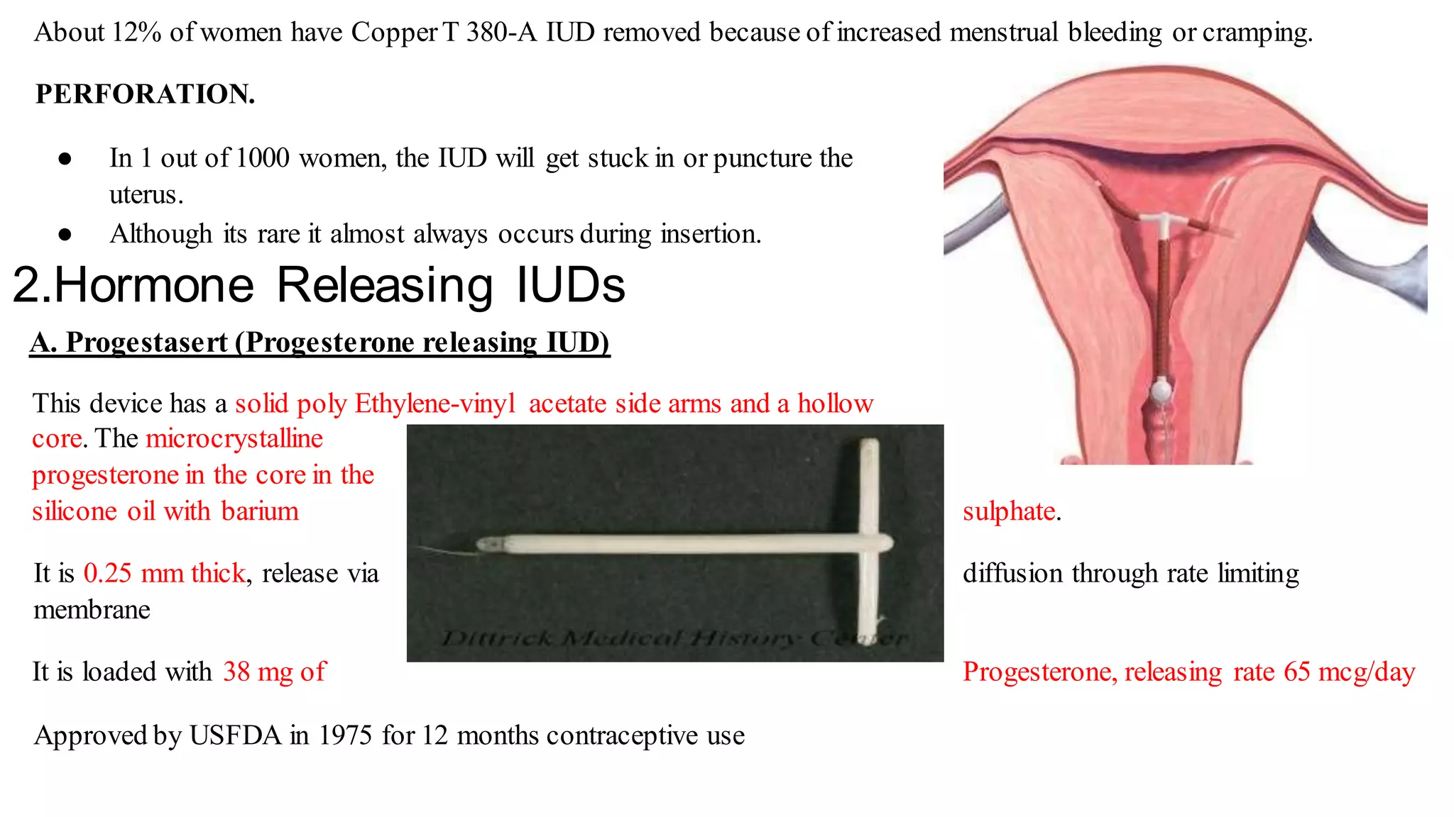 INTRAUTERINE DRUG DELIVERY SYSTEM.docx