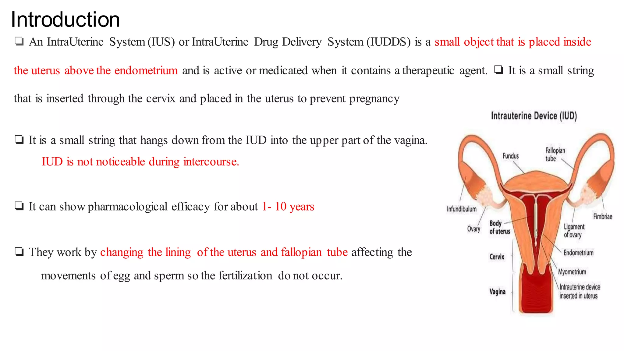 INTRAUTERINE DRUG DELIVERY SYSTEM.docx