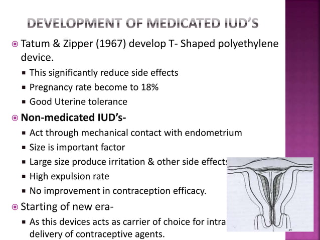 INTRAUTERINE DRUG DEVICES.ppt | Birth Control | Reproductive Health