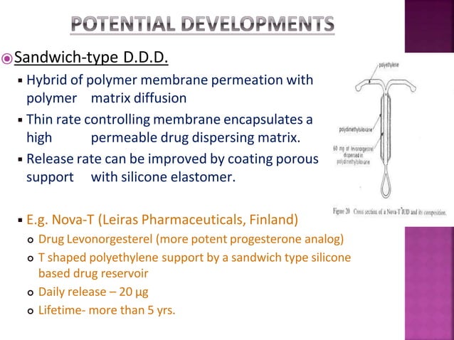 IntraUterine System (IUS) or IntraUterine Drug Delivery System (IUDDS ...