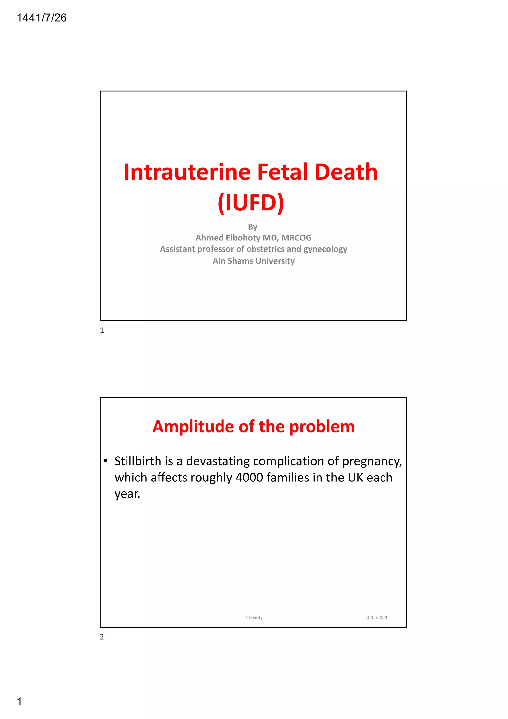 Intrauterine fetal demise (iufd) | PDF